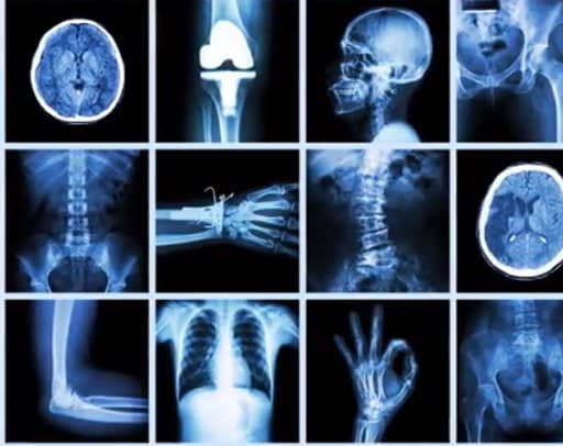 What You Need to Know Before You Get an X-ray - RAYUS Radiology