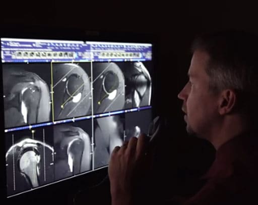 What It’s Like to Get an Arthrogram - RAYUS Radiology