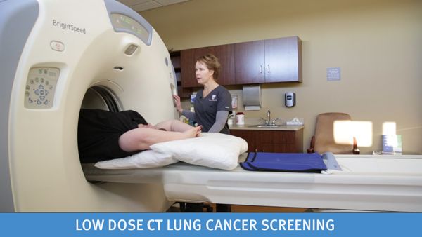 How to Convince a Smoker You Love to Get a CT Lung Cancer Screening ...